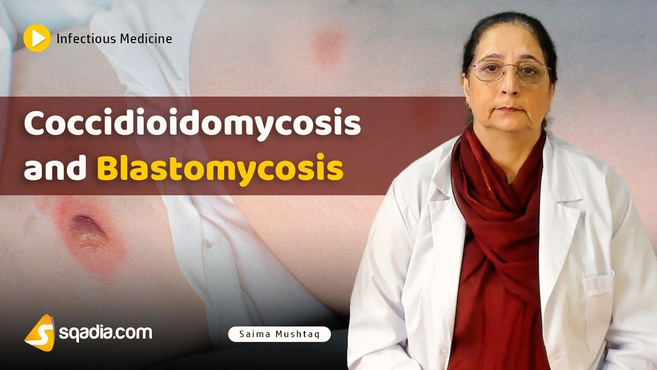 Coccidioidomycosis and Blastomycosis | Internal Medicine Infectious ...