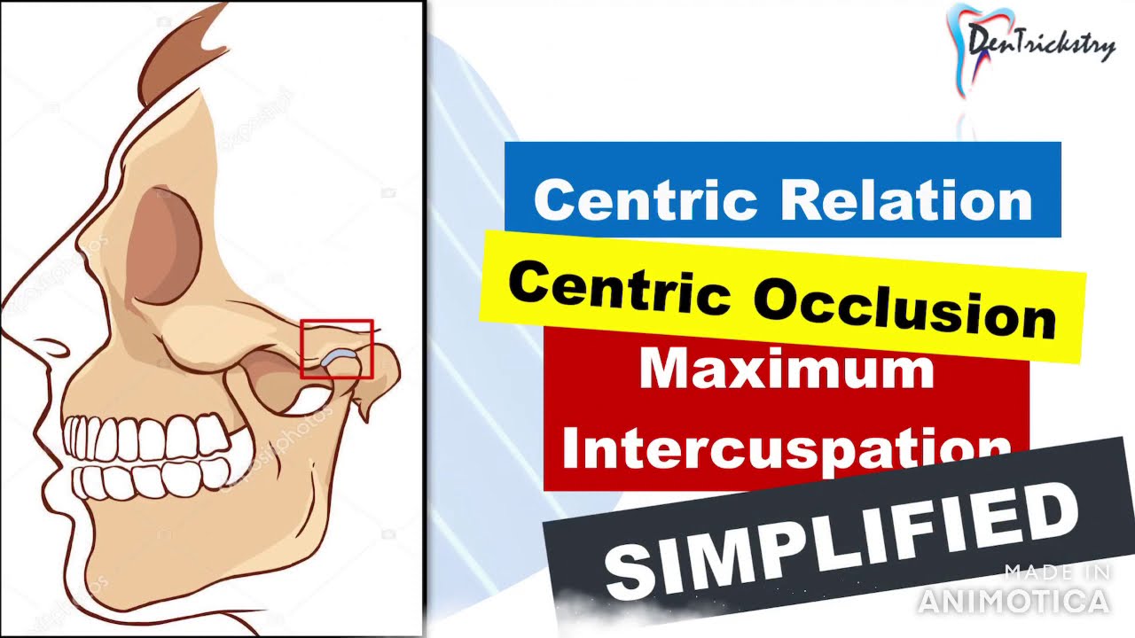 Centric Relation Centric Occlusion Maximum Intercuspal Position CR centric-relation-centric-occlusion-maximum-intercuspal-position-cr