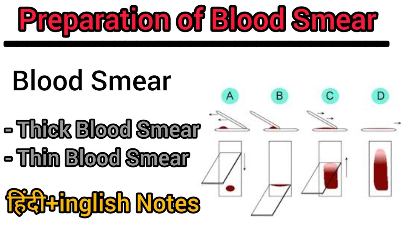 Blood Smear preparation Notes || smear कैसे बनाते हैं - YouTube