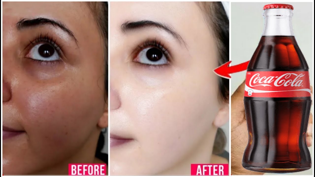 How to Whitening your Skin at Home with Coca Cola |Apply It 5 Minutes ...
