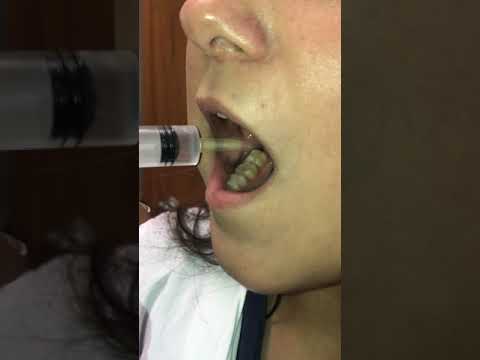 How To Take Care Of Wisdom Teeth Holes