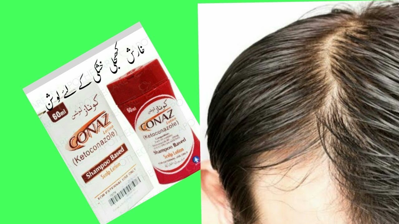 Conaz lotion based shampoo Review - YouTube