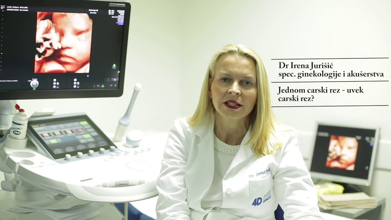 Jednom carski rez - uvek carski rez? - YouTube