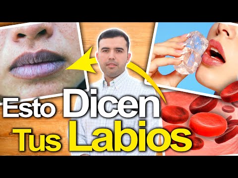 Esto Revelan Tus Labios - Enfermedades Que Muestran Tus Labios Y Cómo Solucionarlo