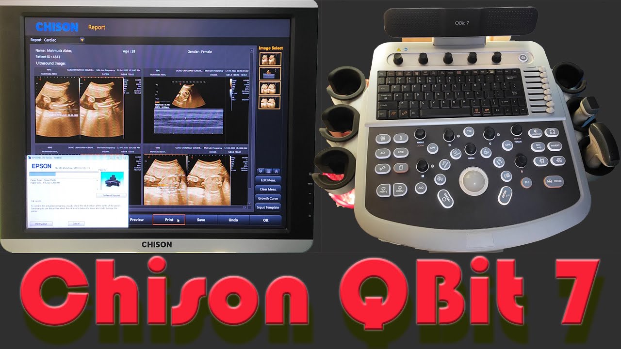 Chison QBit 7 Ultrasonography Machine for Beginnersকিভাবে Chison QBit 7 দিয়ে Pregnancy profile ...