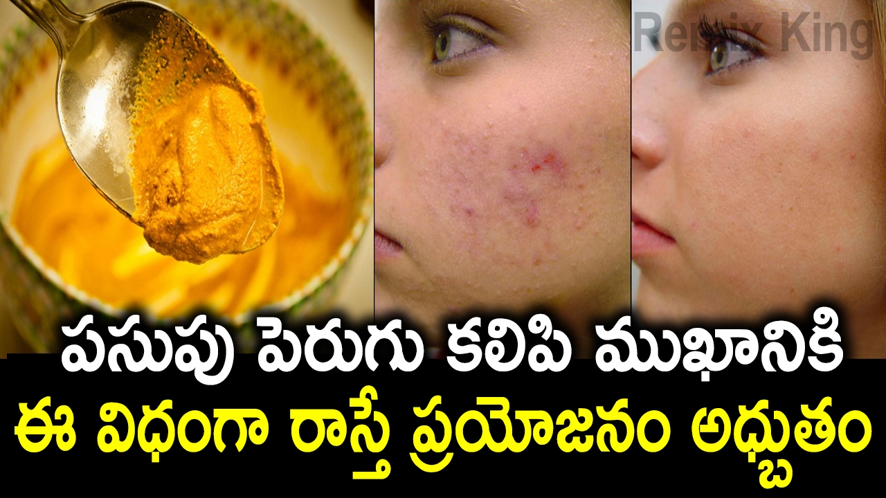 Amazing Beauty Benefits of Turmeric and Curd Mix | పెరుగు పసుపు కలిపి ...