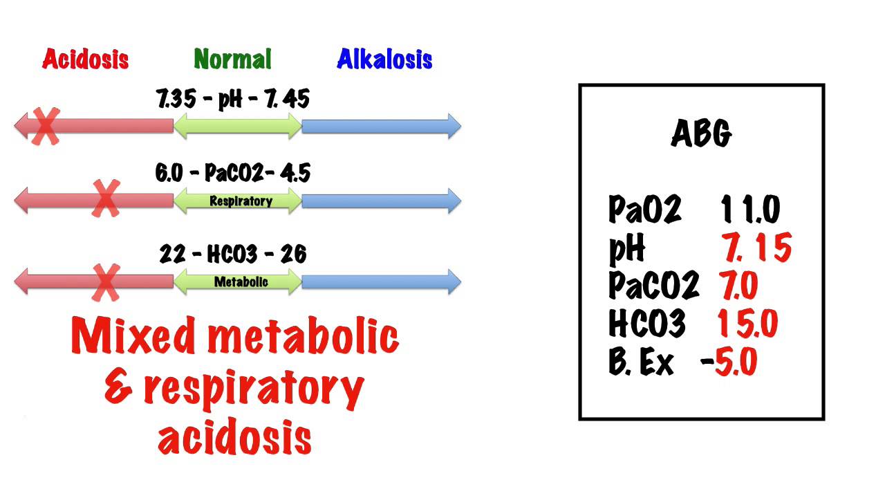 Respiratory: ABG Interpretation - YouTube