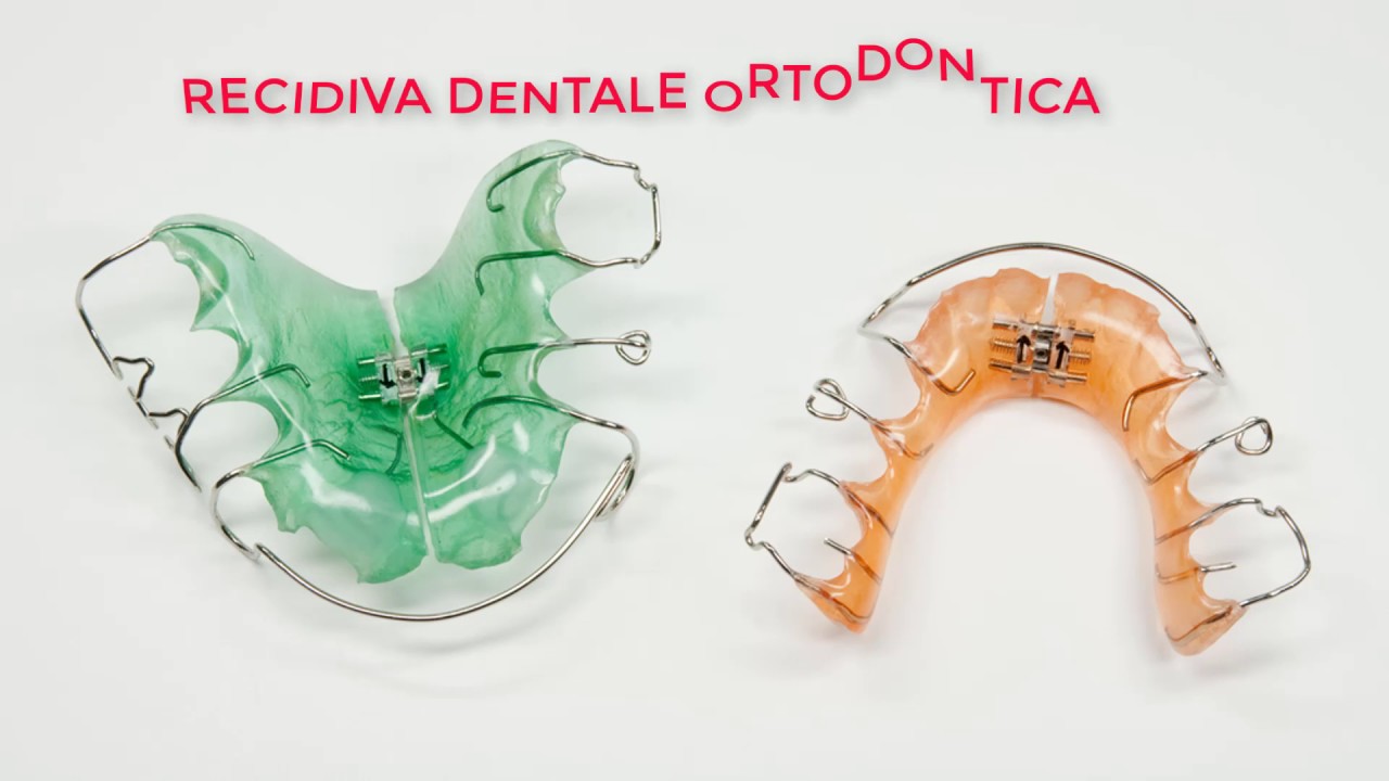 ORTODONZIA MOBILE BRESCIA: sai cosa è il fenomeno della recidiva ...