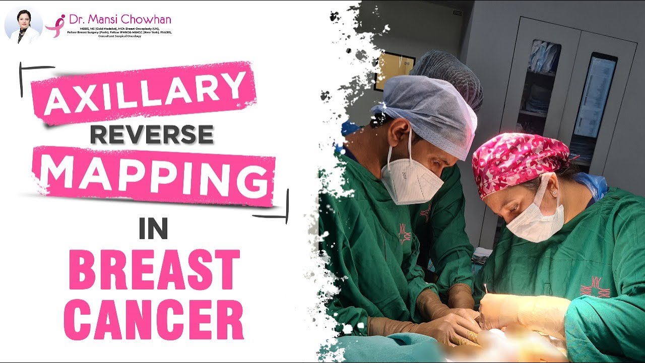 Axillary Reverse Mapping in Breast cancer #breastcancer #cancer - YouTube