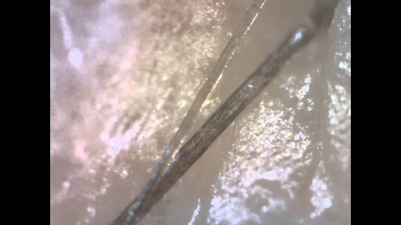Microscopic structure of a hair - YouTube