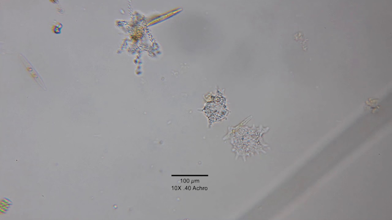 Pond Life Through the Microscope: Amoeba; Amoebae 12 Reproduction - YouTube