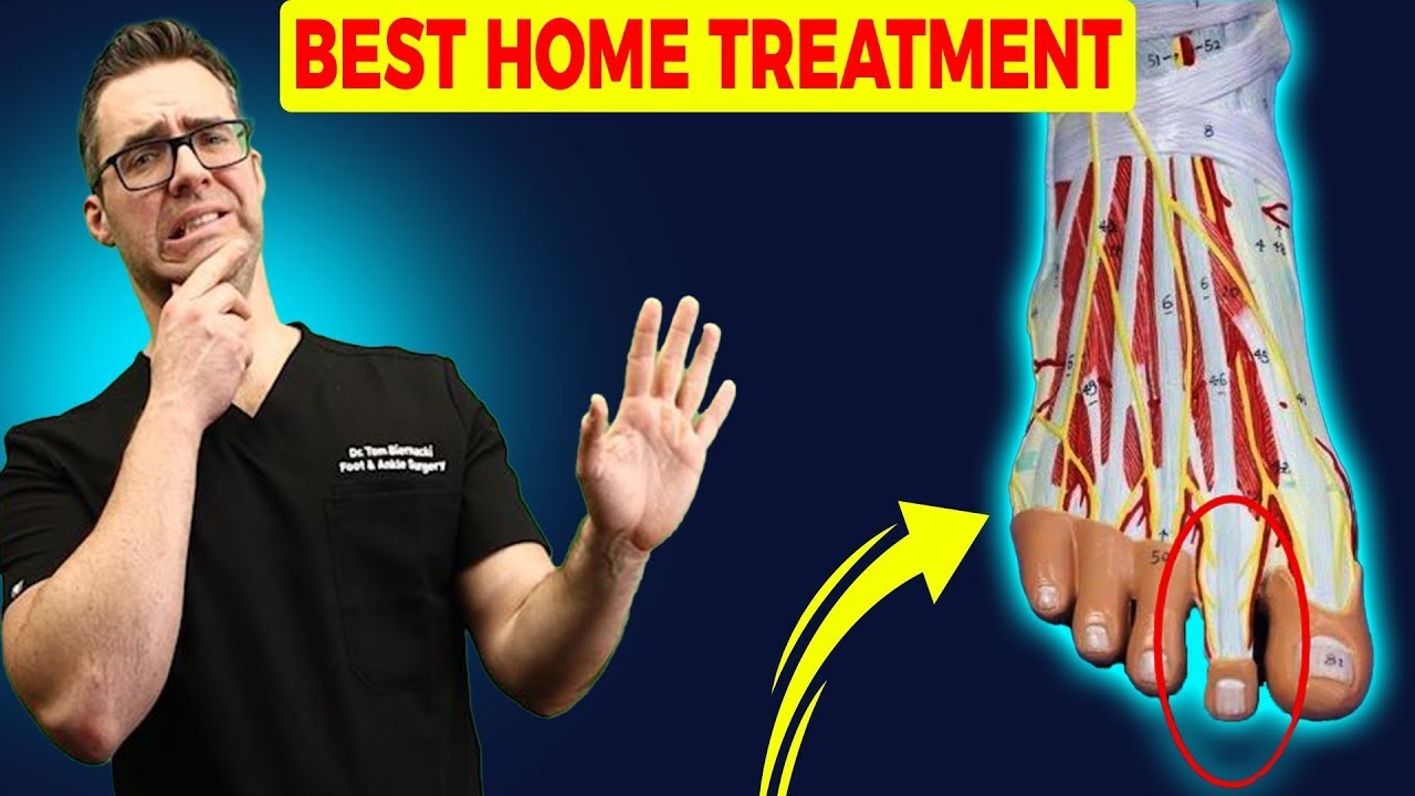 Swollen Top of Foot or Top of Foot Tendonitis? [FIX Top of Foot Pain ...