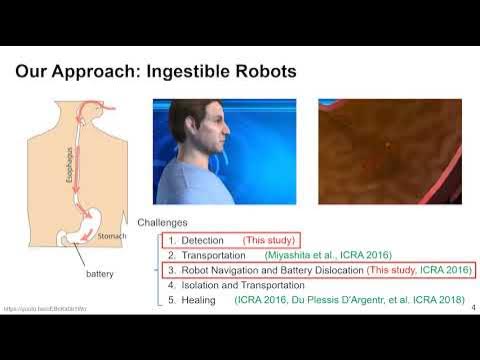 Jialun Chester Liu - "Topographic Localization for Ingested Button Battery" ICRA 2020 ...
