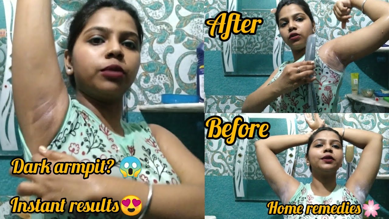 How To Lighten Your Dark Underarms Effective Home Remedies In Just how-to-lighten-your-dark-underarms-effective-home-remedies-in-just