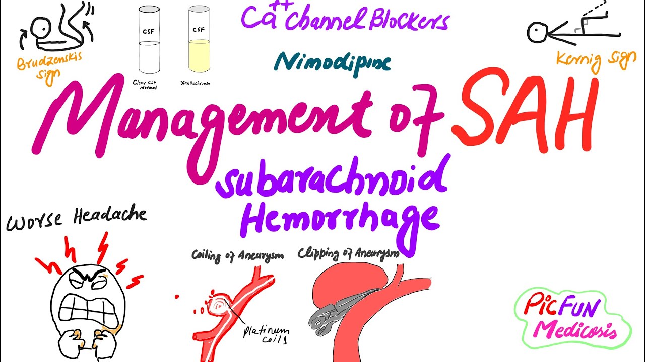 Management Of Subarachnoid Hemorrhage Sah Brain Hemorrhage Youtube