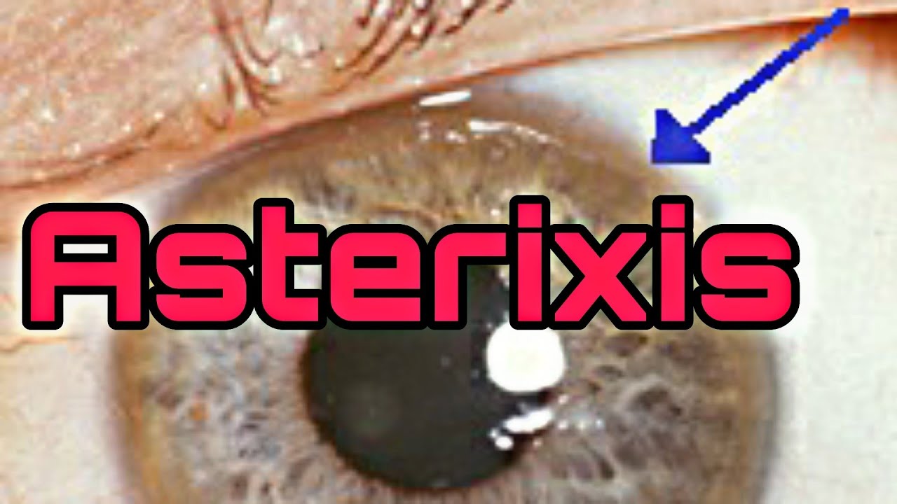 Asterixis|Causes Riskfactors|Symptoms Diagnosis|Treatment For ...
