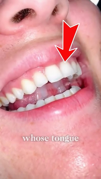 Teach you how to gleek in ten seconds！ - YouTube