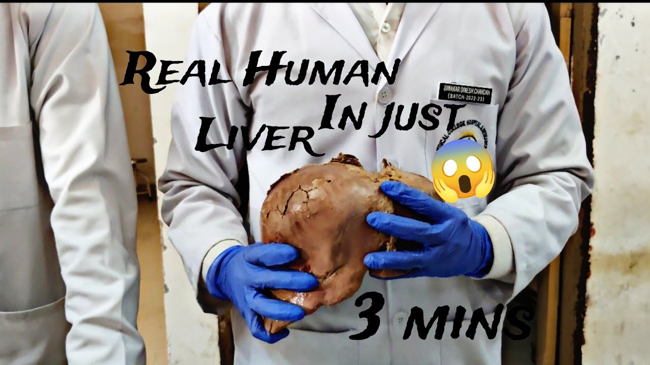 Gross Anatomy of liver -Dissection -DrDDC - YouTube