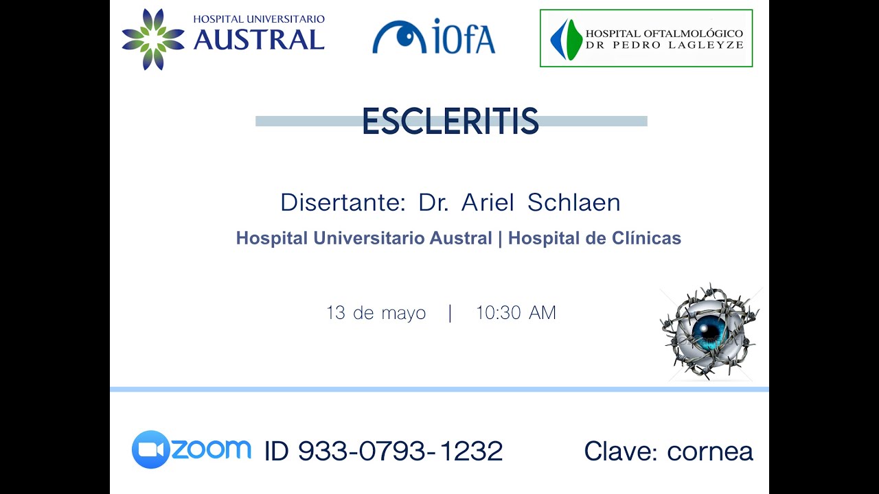Escleritis - Dr. Ariel Schlaen - YouTube