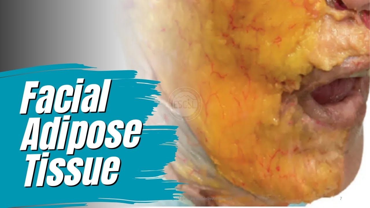 Understanding Facial Adipose Tissue (Fat) And Comprehensive Knowledge ...