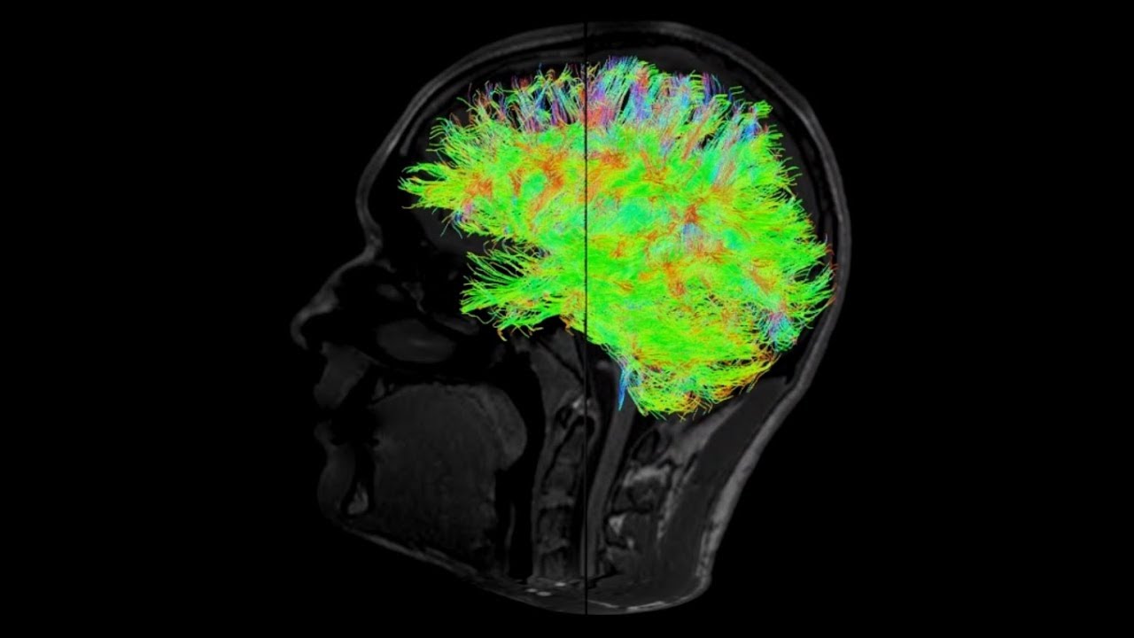 Connectome from Diffusion Tensor Imaging (DTI) - YouTube