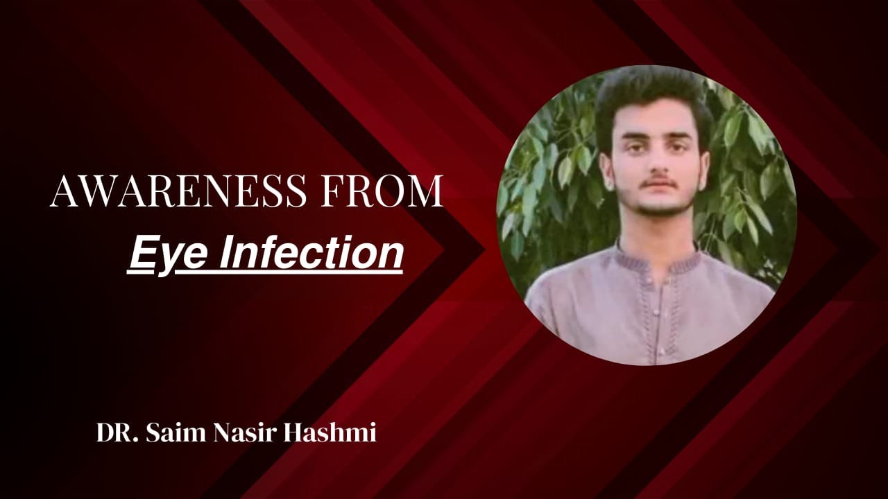 Eyes Infection In Pakistan | Big Warning To Conjunctivitis Patients ...