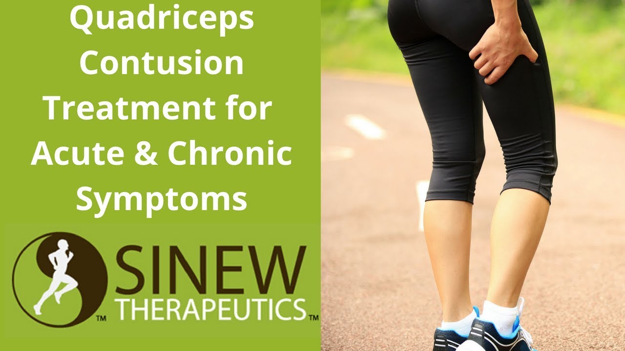 Quadriceps Contusion Treatment for Acute and Chronic Stage Symptoms ...