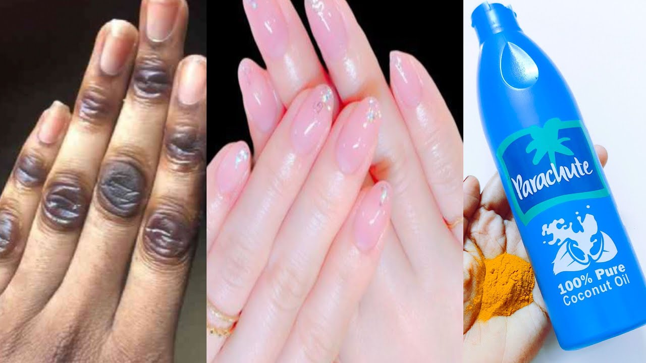 Hand whitening secret home remedies | Hand whitening cream | Hand ...