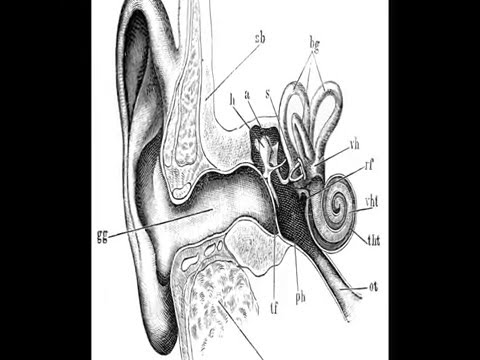 LOUD HIGH-PITCHED RINGING IN EARS? SEE WHAT I FOUND IN MY EARS ...