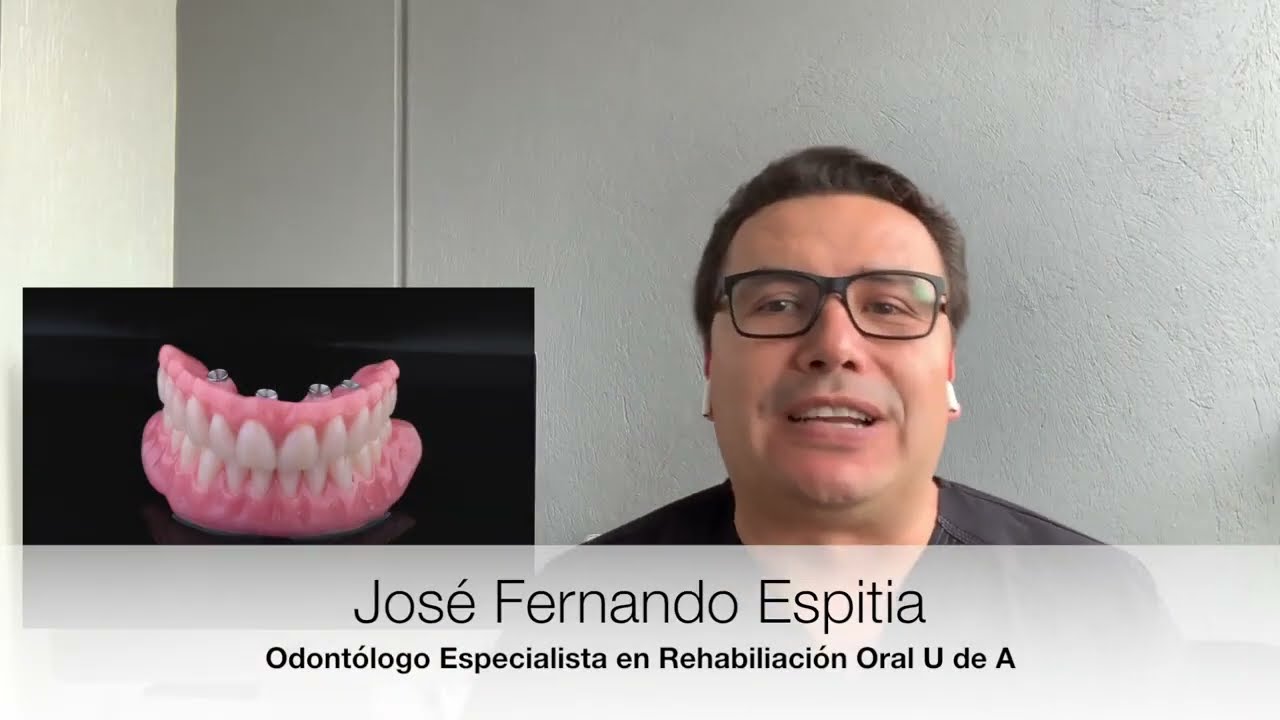 Costos y tiempos en prótesis con implantes de arco completo por maxilar ...