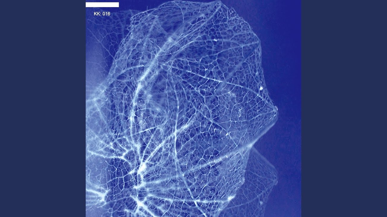 Opale 3 [braide] - YouTube Music