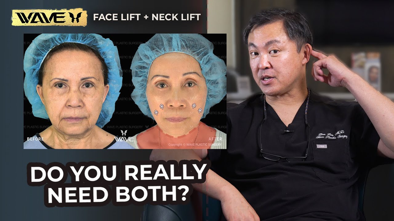 Face Lift or Neck Lift? - Do You Need Both? | Wave Plastic Surgery ...