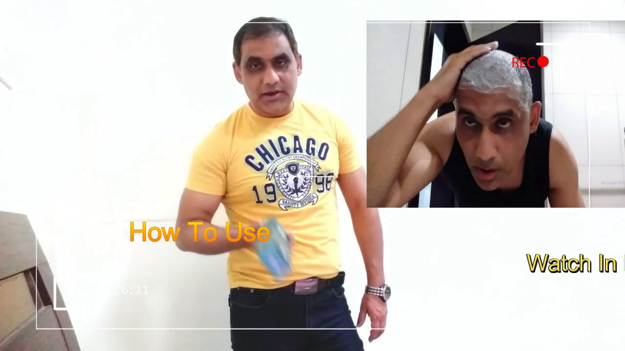 100% Dandruff Free In Just One Week | Kenz-Sal Lotion or Salicylic Acid ...