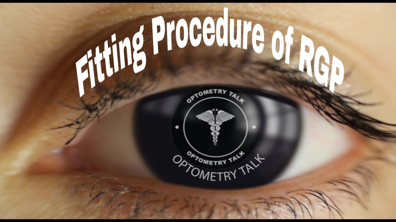Fitting Of RGP Contact Lens YouTube