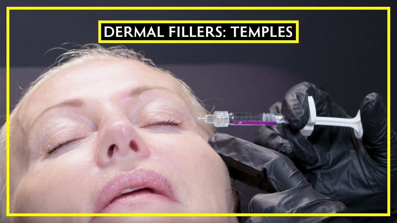 Temple Fillers For A Former Model - YouTube