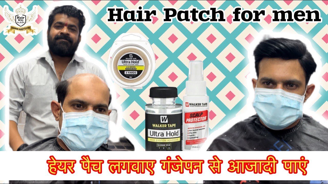Hair Patch For Men | Call Us 9250668001 | Hair Patch Center In India ...