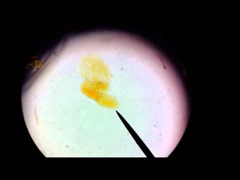 iodine-stained cheek-cell scrape: the older you are the more inclusion ...