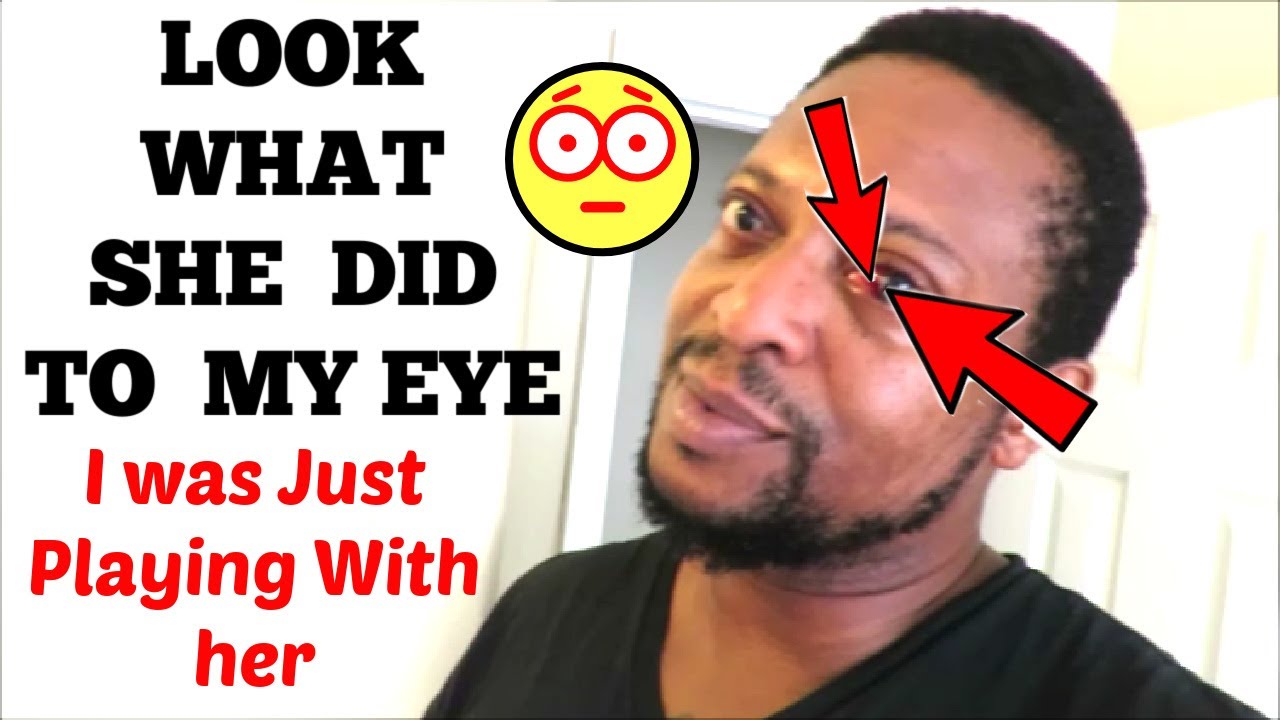How I Almost Lost My Eye Again (JUST HAPPENED) - YouTube