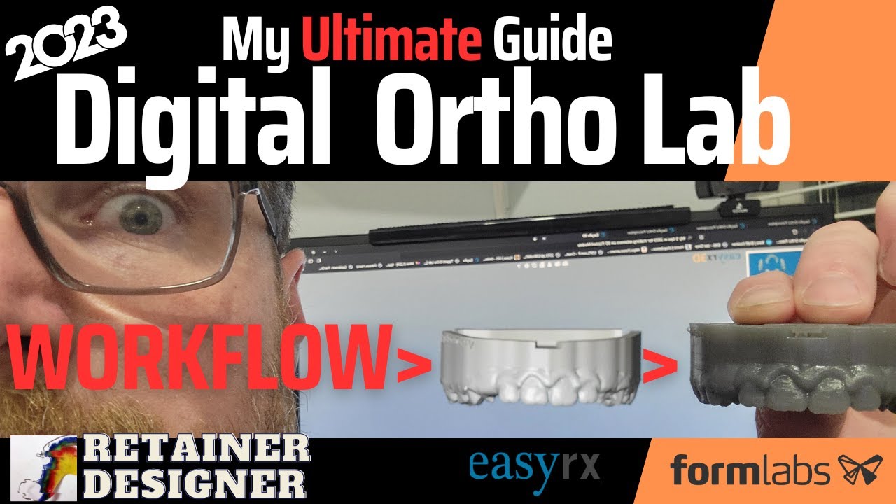 Ultimate Guide: Digital Workflow For A Small Orthodontic Lab! Using Easyrx and Formlab Printers ...
