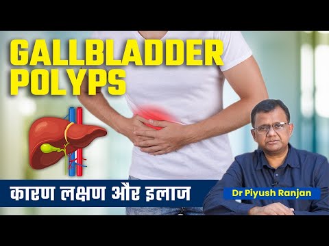 Gallbladder Polyps के कारण, लक्षण और इलाज | Symptoms and Treatment of Gallbladder Polyps