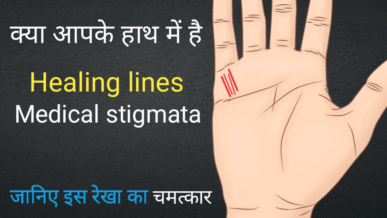क्या आपके हाथ में है Healing lines | Medical stigmata - YouTube