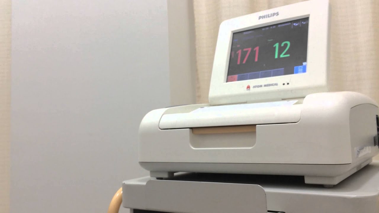 Monitoring Heartbeat and labour contraction.. - YouTube