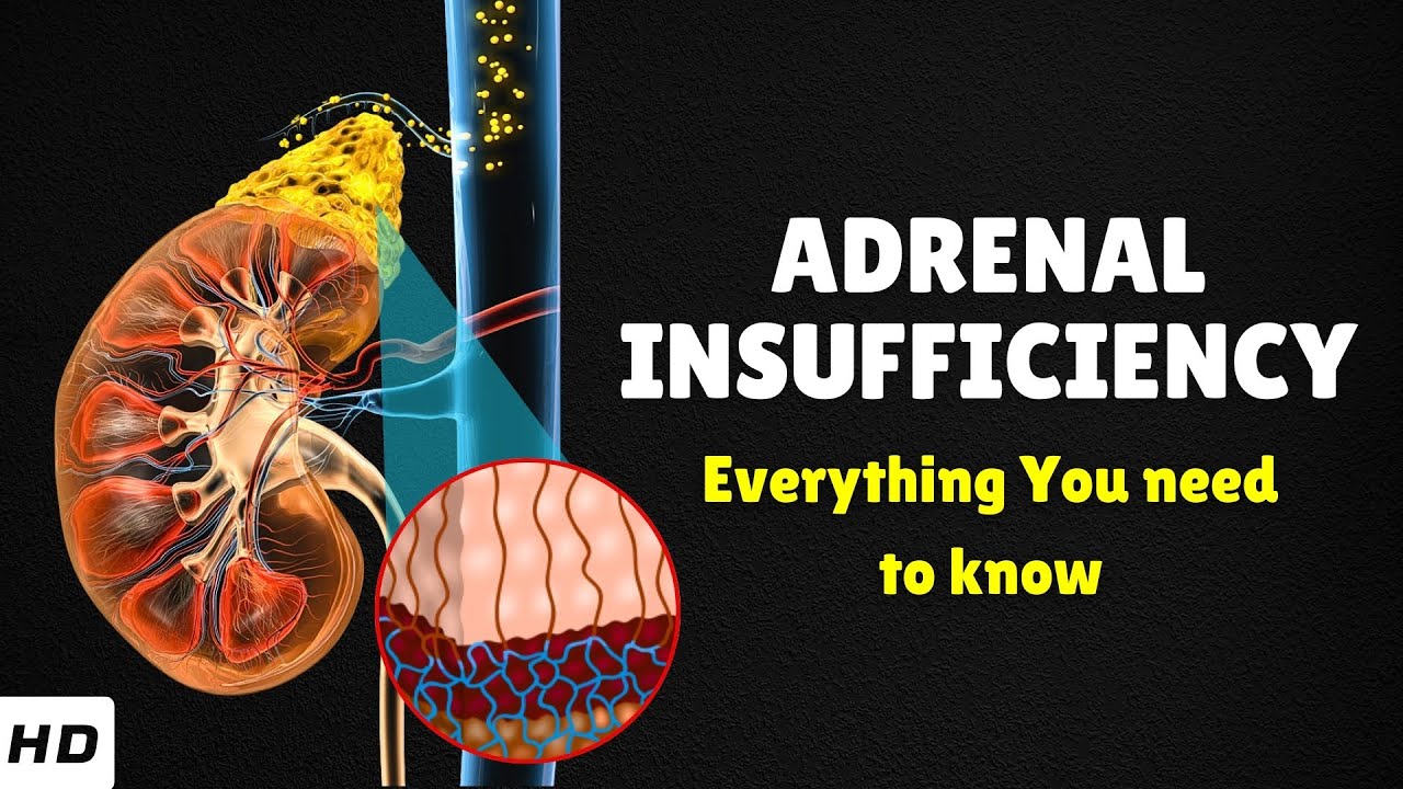 Adrenal Insufficiency – Causes, Signs and Symptoms, Diagnosis ...
