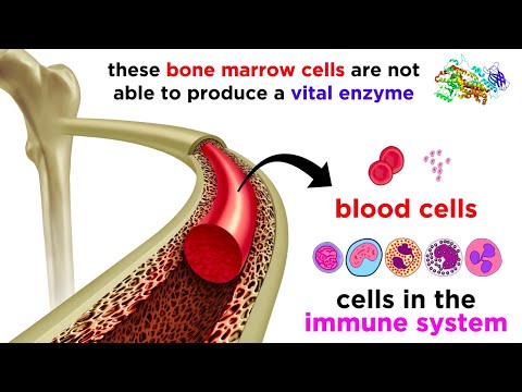 Gene Therapy