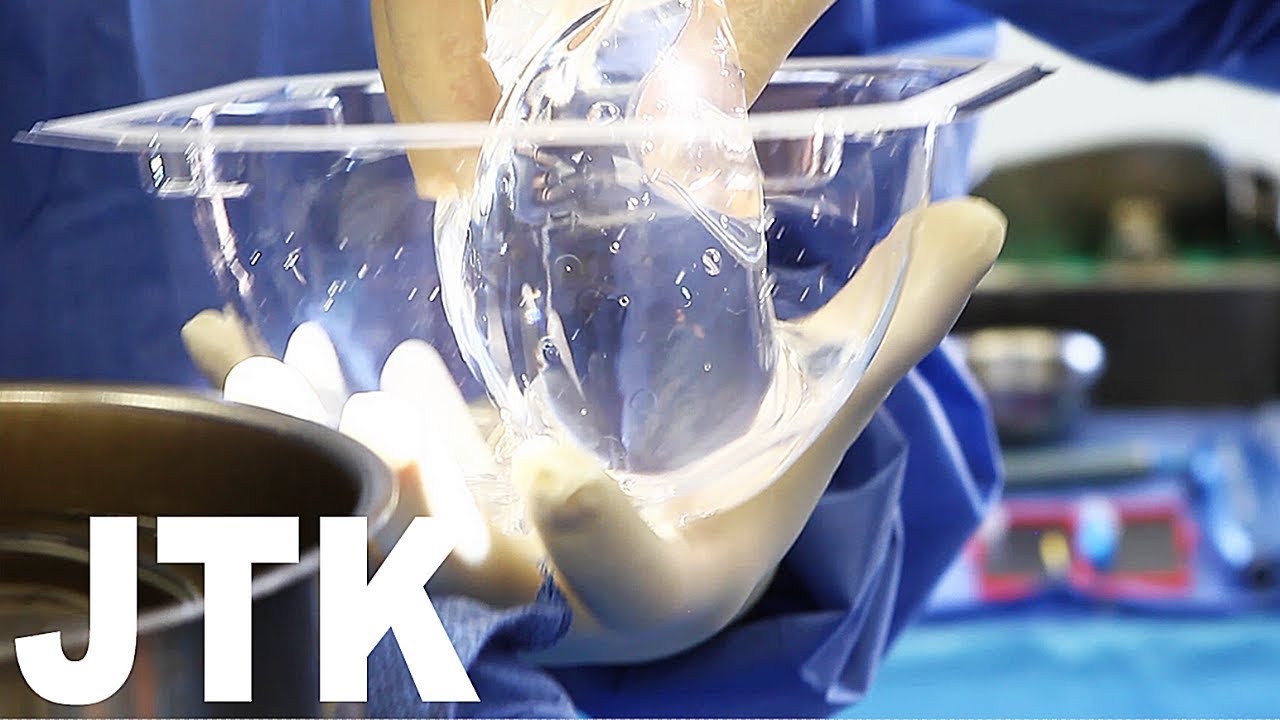 MTF Gender Confirmation Surgery - Safety Tips (Top Surgery) - YouTube