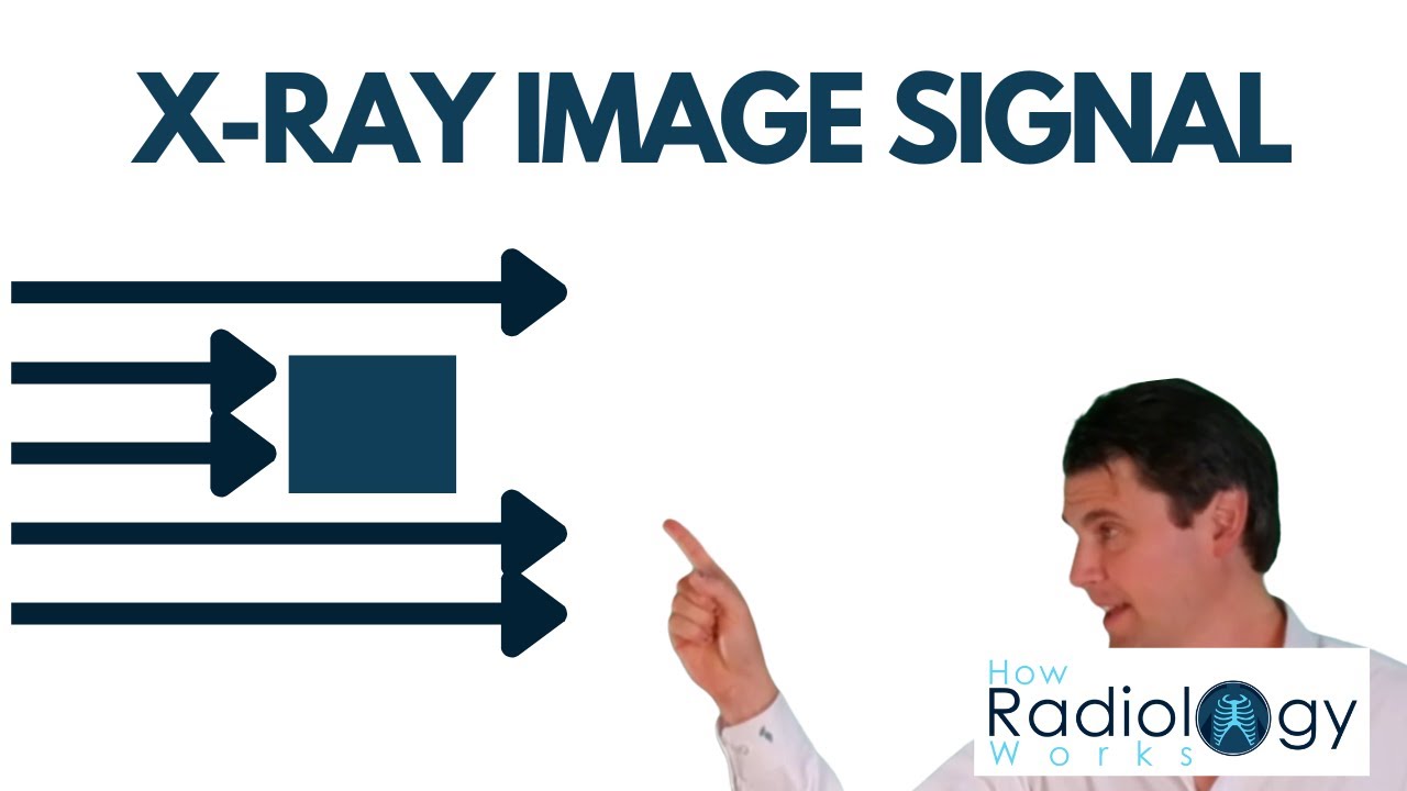 X-ray Image Signal (What impacts X-ray Image?) - YouTube