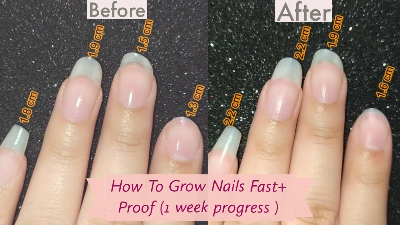 How To Grow Nails Fast With Toothpaste at Lisa Panek blog