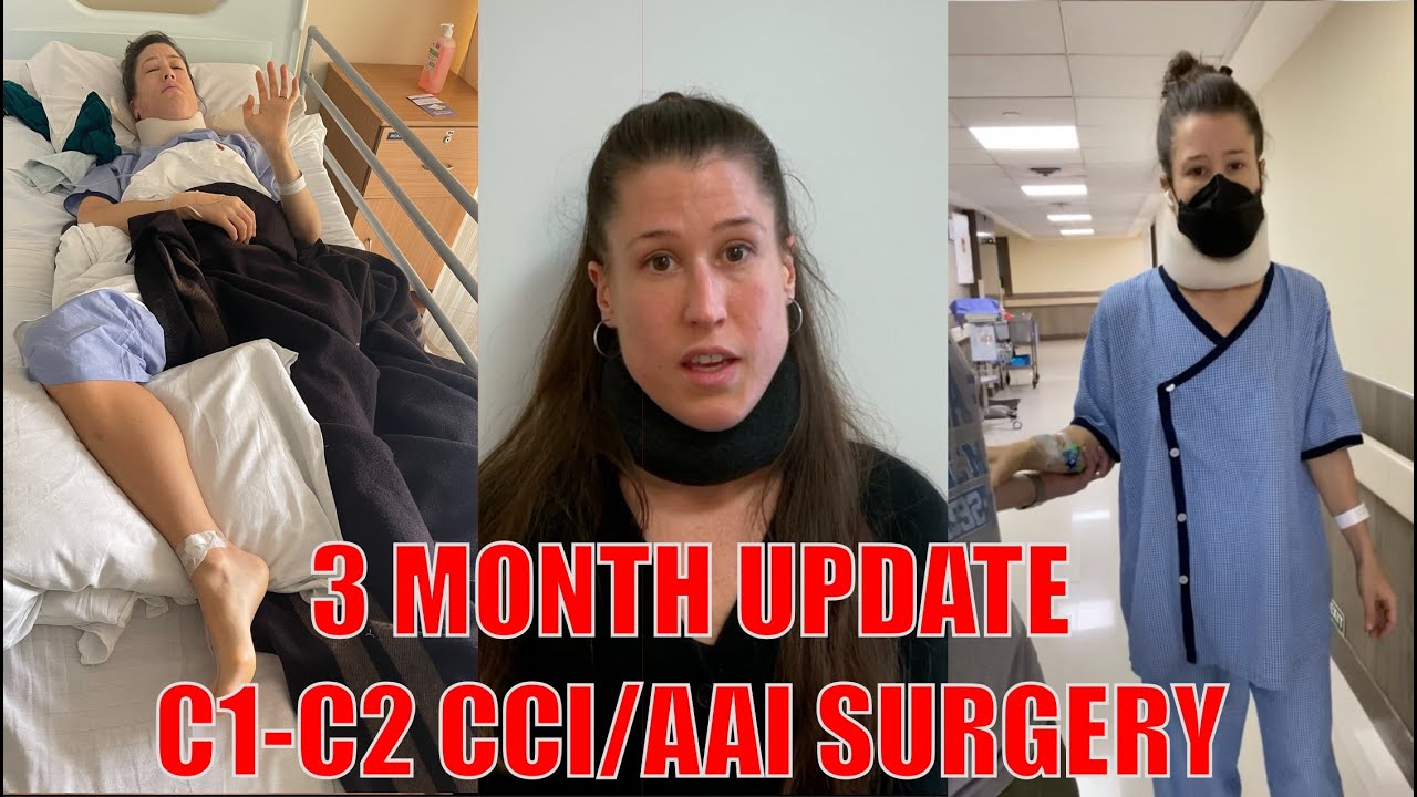3 Month update: C1-C2 Fusion Surgery #AAI #CCI #WeNeedToTalkAboutCCI ...