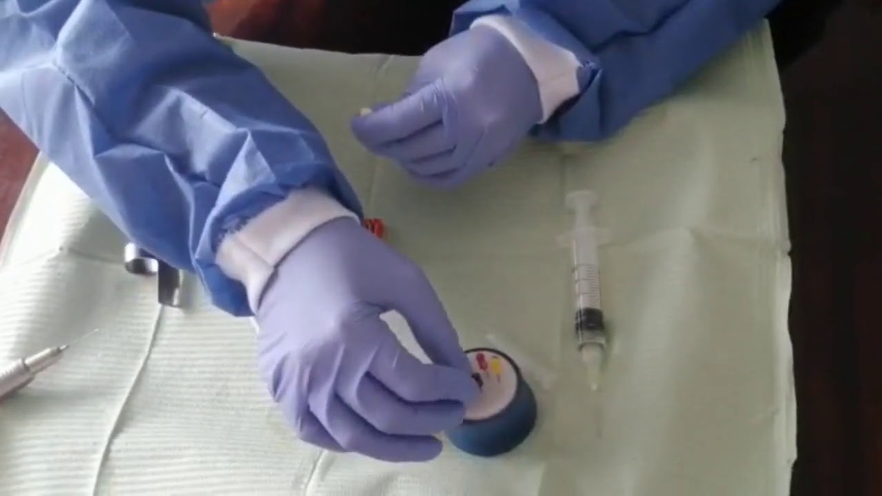 Video Endodoncia, Técnica de Crown Down - YouTube