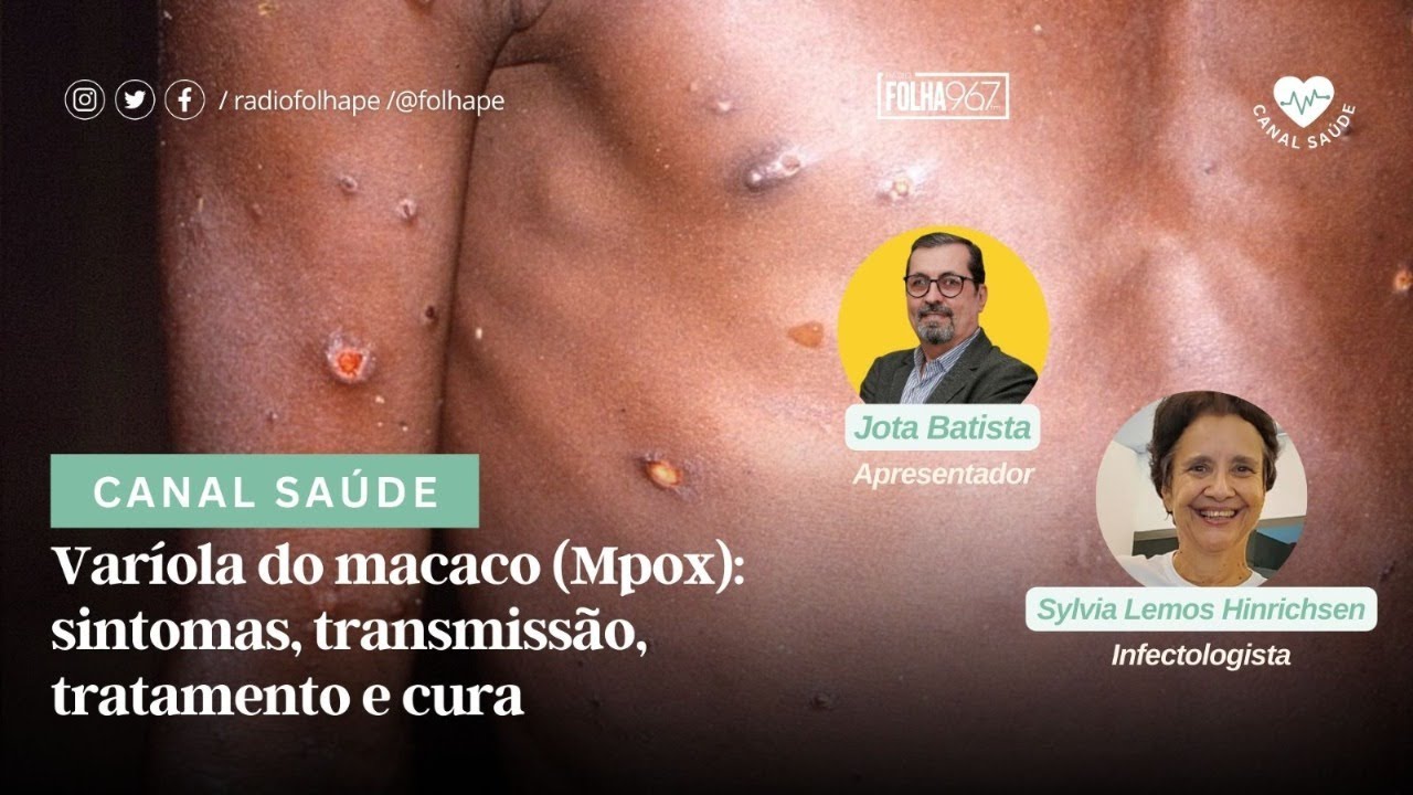 CANAL SAÚDE | VARÍOLA DO MACACO (MPOX): SINTOMAS, TRANSMISSÃO ...